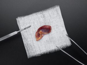 Infectious Laryngotracheitis (ILT) in Chickens: Causes, Symptoms, and ...